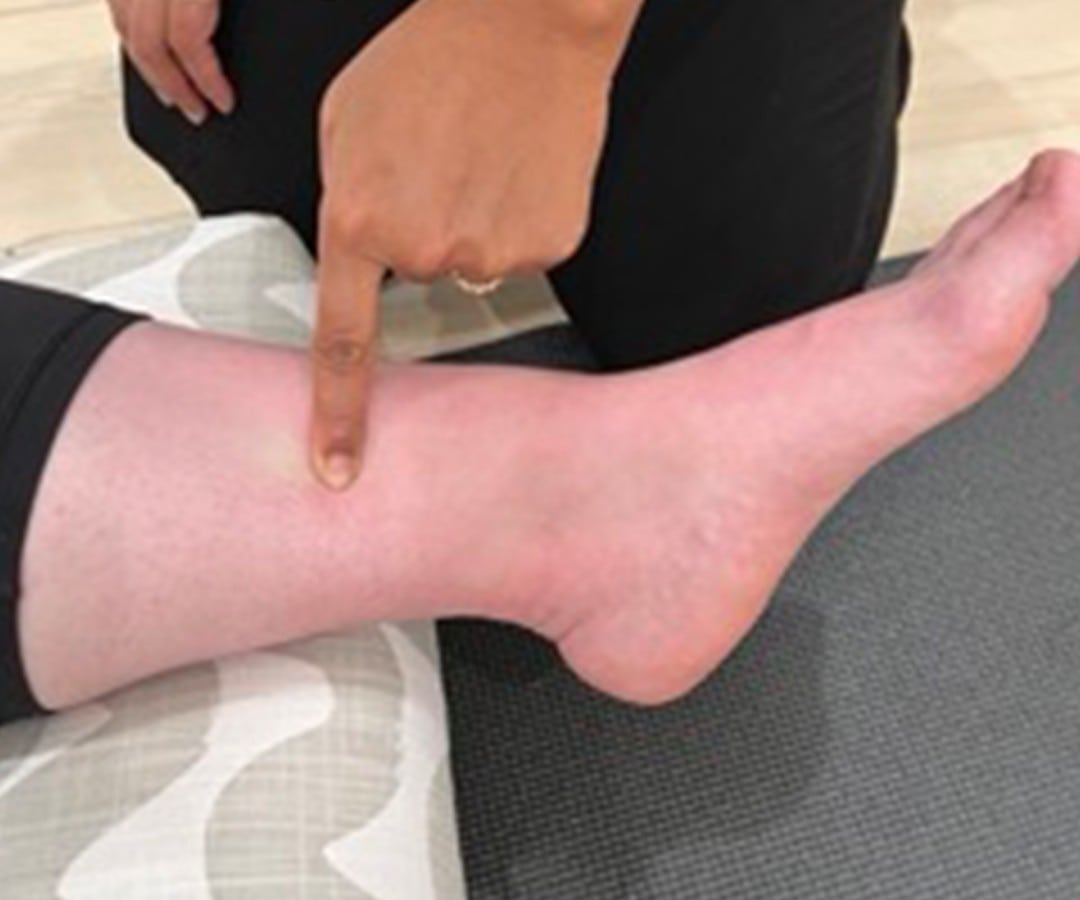 Understanding Acupressure Points for Labour and Birth - Oona
